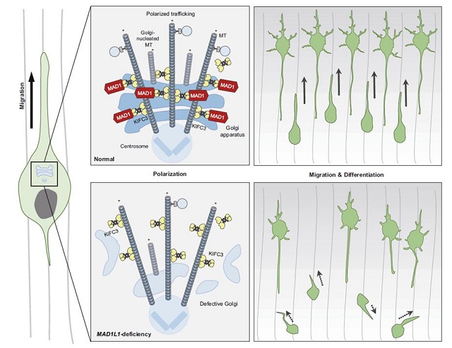 POSTECH, ‘조현병’ 태아 신경발달 과정에서 발생 | Save Internet 뉴데일리